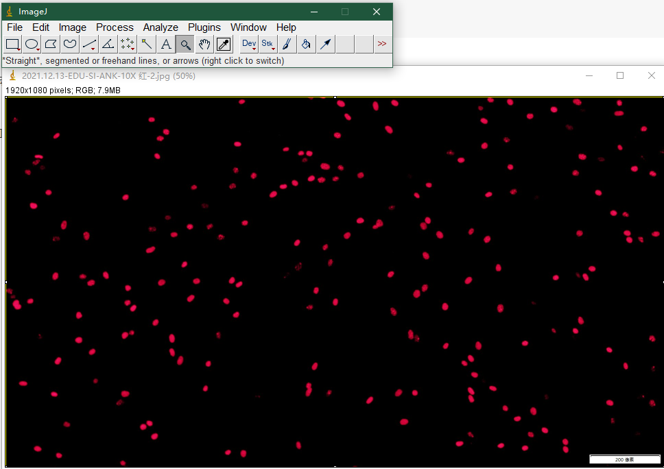 imageJ细胞计数 | WSZ@blog